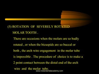 Rotational control in orthodontics | PPT