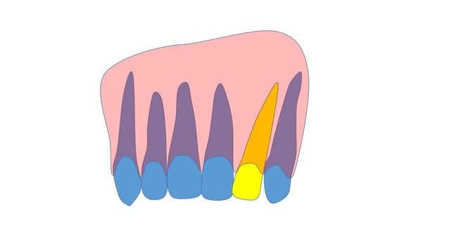 Alignment and rectangular loop | PPTX