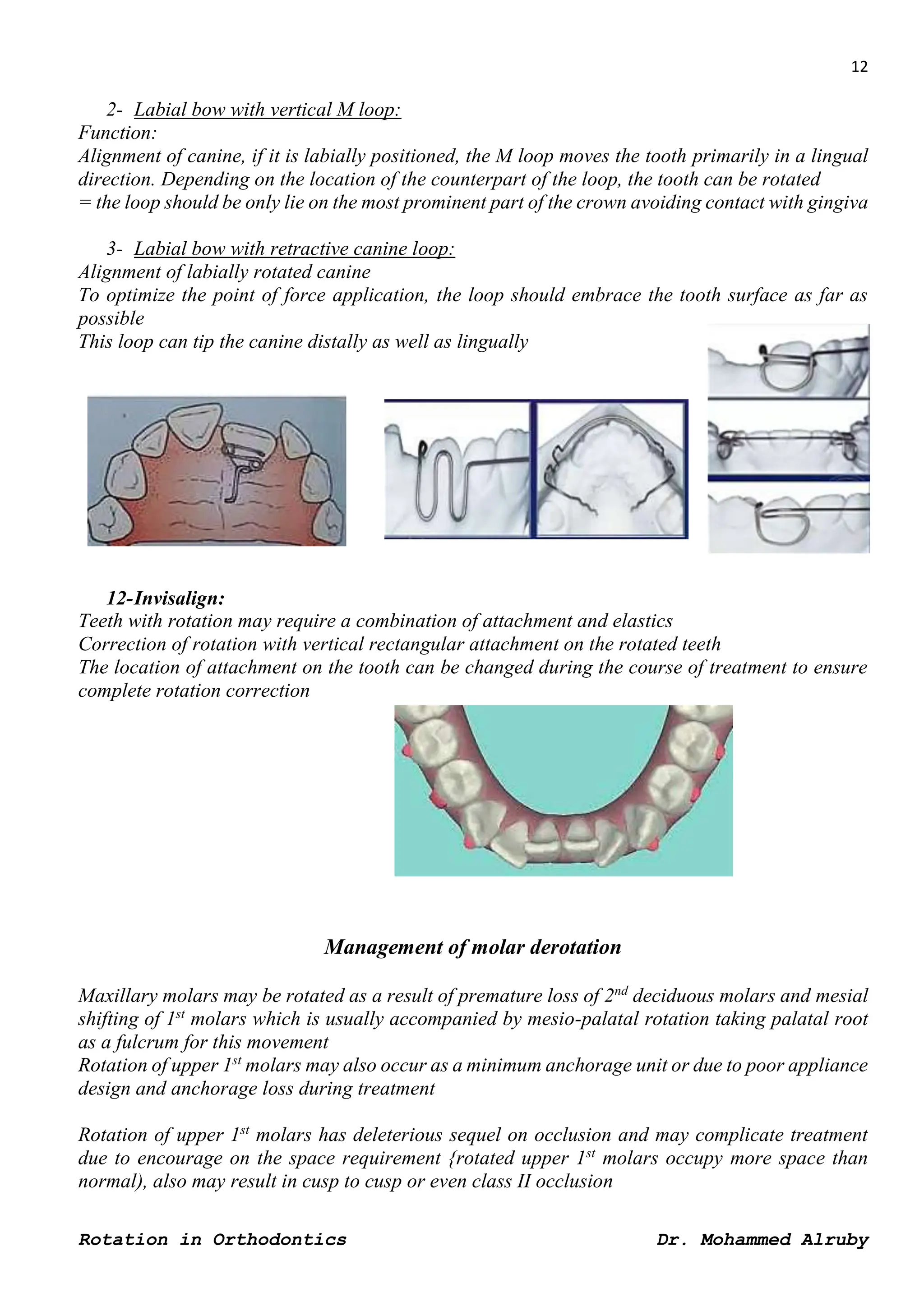 Rotation in orthodontics.docx