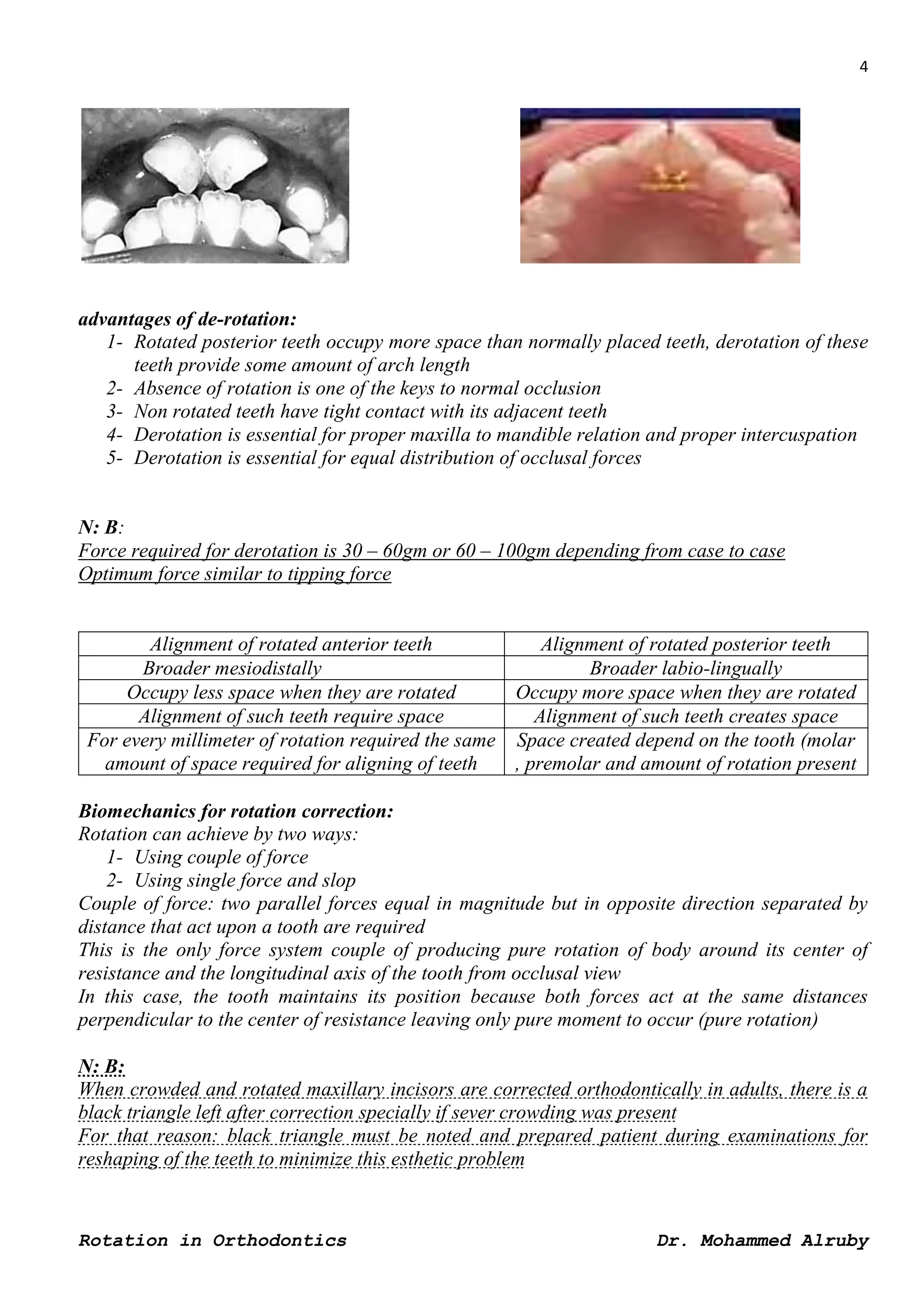 Rotation in orthodontics.docx
