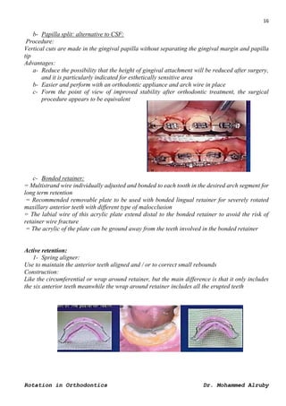 Rotation in orthodontics.docx