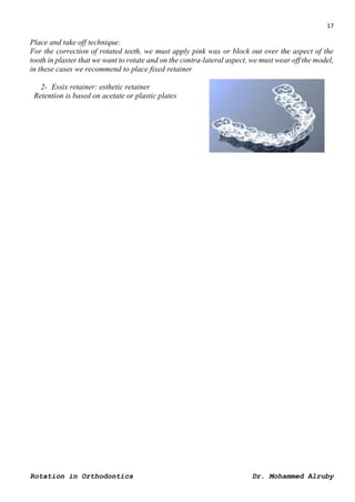 Rotation in orthodontics.docx