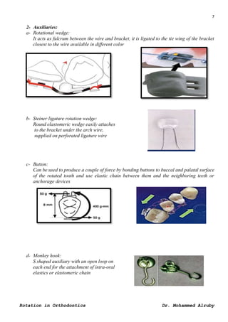 Rotation in orthodontics.docx