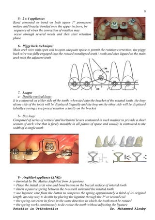 Rotation in orthodontics.docx