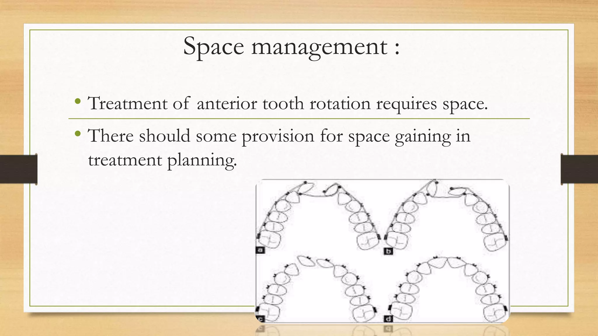 Rotation of teeth & its management | PPTX