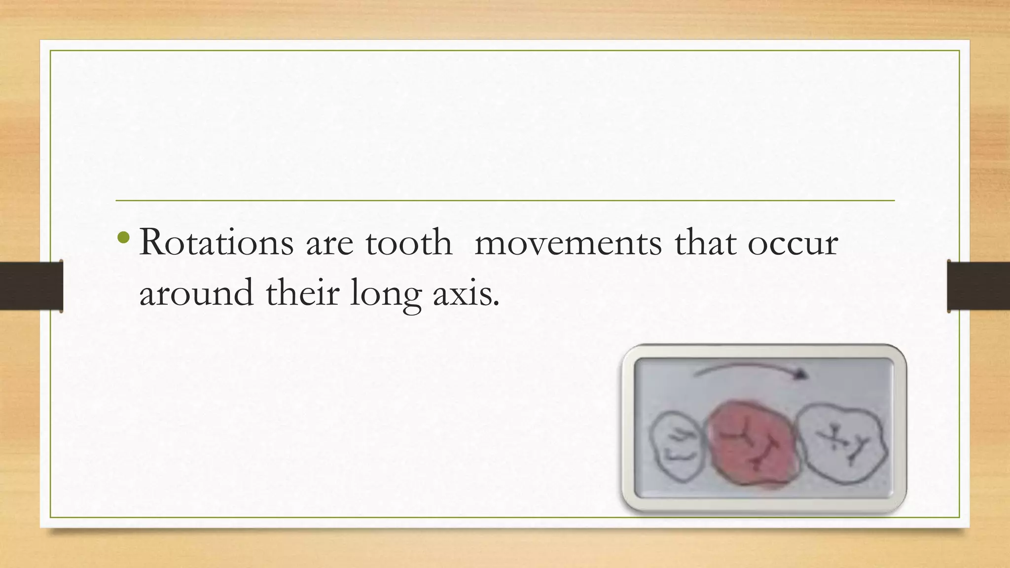 Rotation of teeth & its management | PPTX