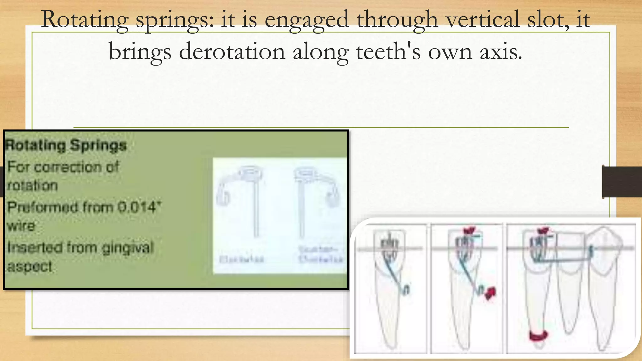 Rotation of teeth & its management | PPTX