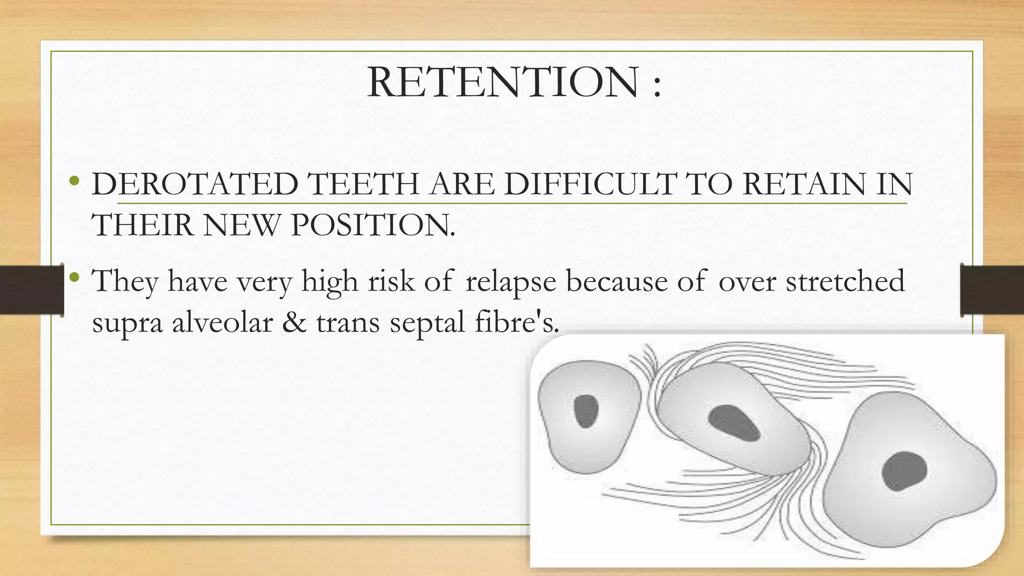 Rotation of teeth & its management | PPTX