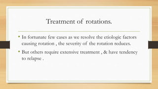 Rotation of teeth & its management | PPTX