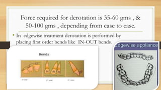 Rotation of teeth & its management | PPTX