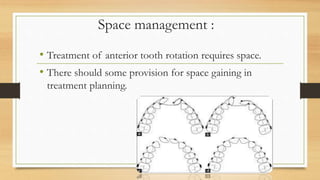 Rotation of teeth & its management | PPTX
