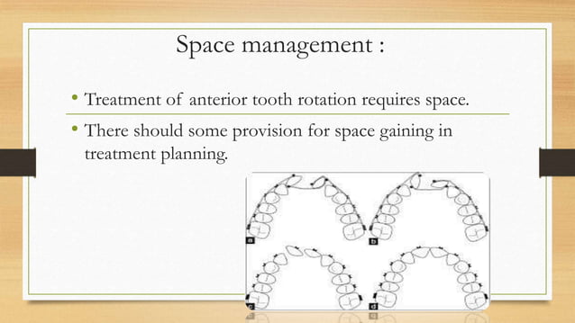 Rotation of teeth & its management | PPTX | Oral care | Personal Care