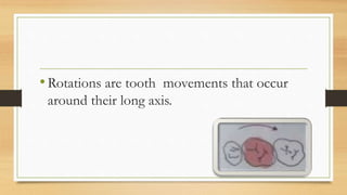 Rotation of teeth & its management | PPTX