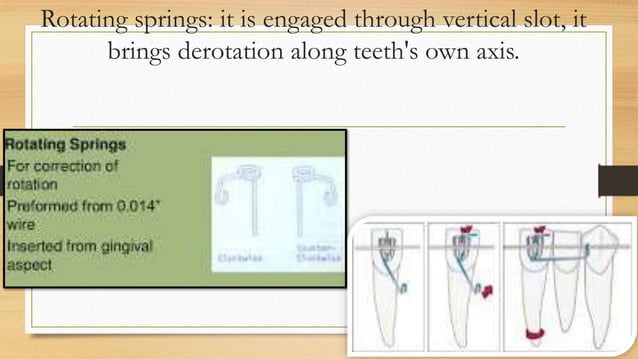 Rotation of teeth & its management | PPTX | Oral care | Personal Care