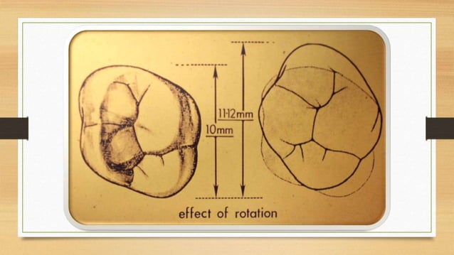 Rotation of teeth & its management | PPTX | Oral care | Personal Care