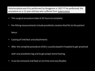 Rotationplasty | PDF