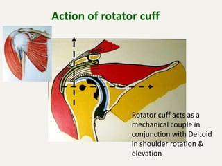 Rotator cuff Tear and its management | PPTX