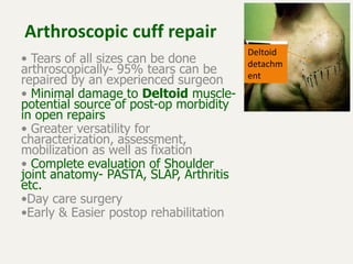 Rotator cuff Tear and its management | PPTX