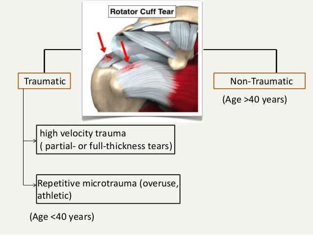Rotator cuff Tear and its management