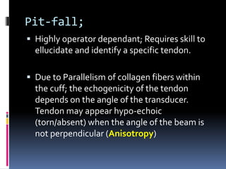 Rotator cuff | PPTX
