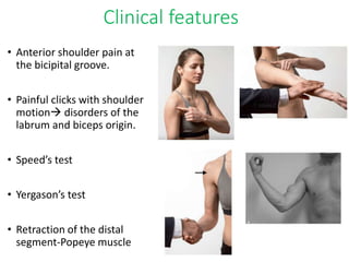 Rotator cuff disorders, bicipital tendinopathies | PPT