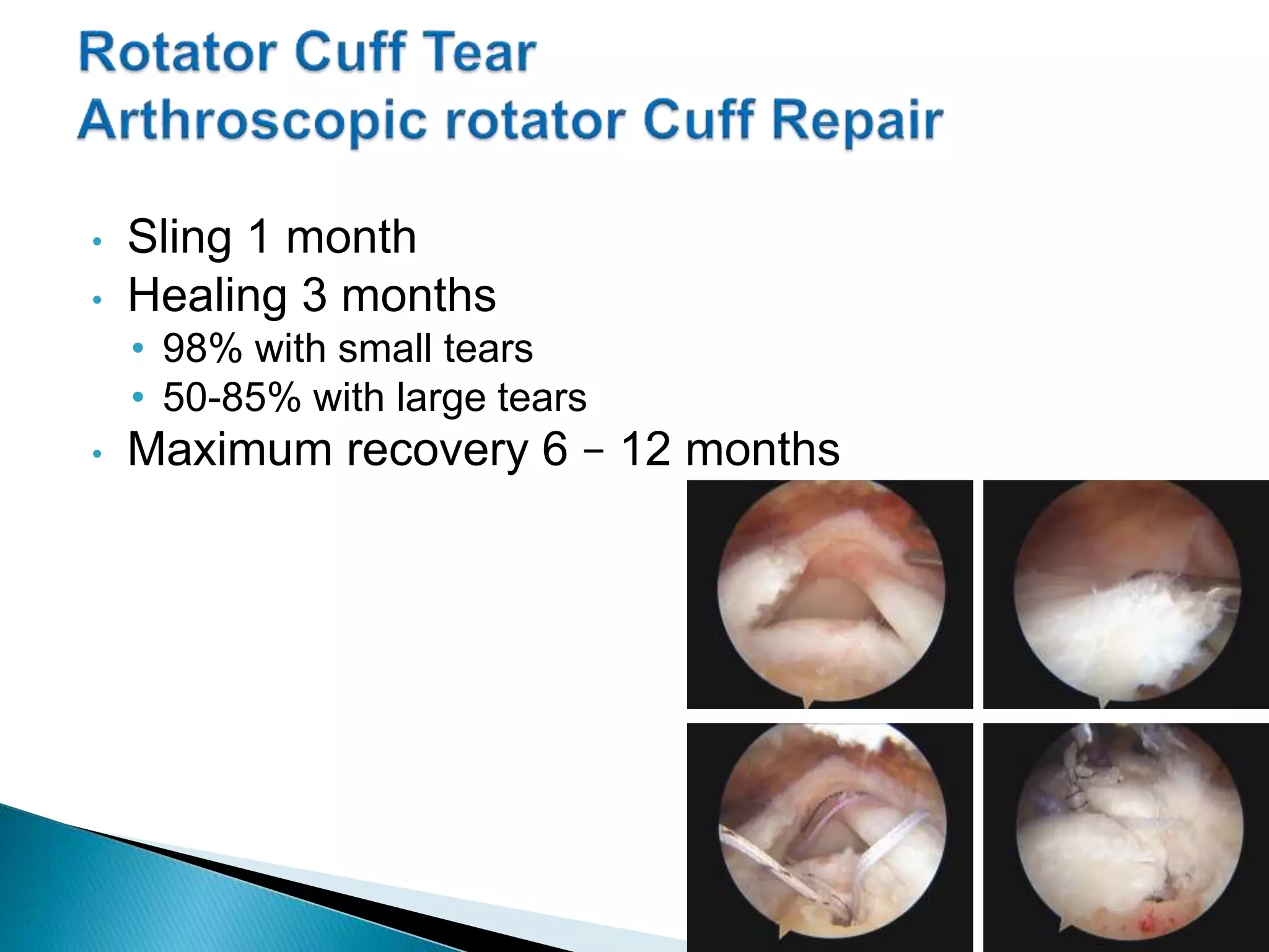 Rotator cuff disorder | PPTX