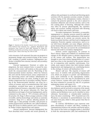 Rotator Cuff Disorders | Shoulder Surgeon | Greater Denver Colorado | PDF