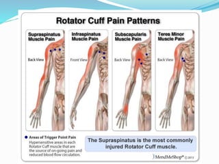 Rotator Cuff Tear Test