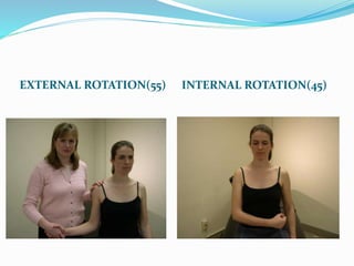 Rotator cuff injuries | PPT
