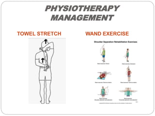 Rotator cuff injuries | PPTX