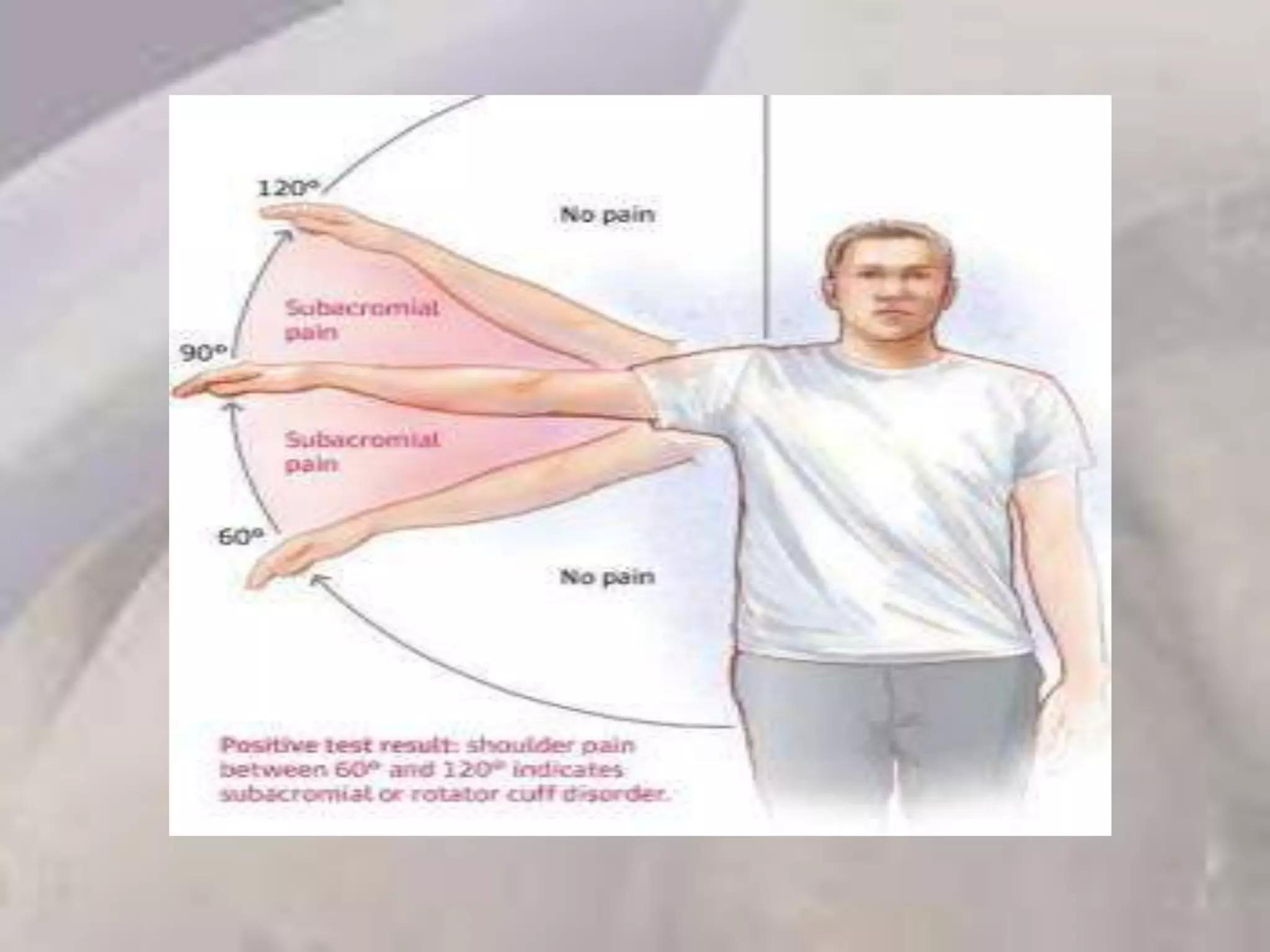 rotator cuff injuries.pptx