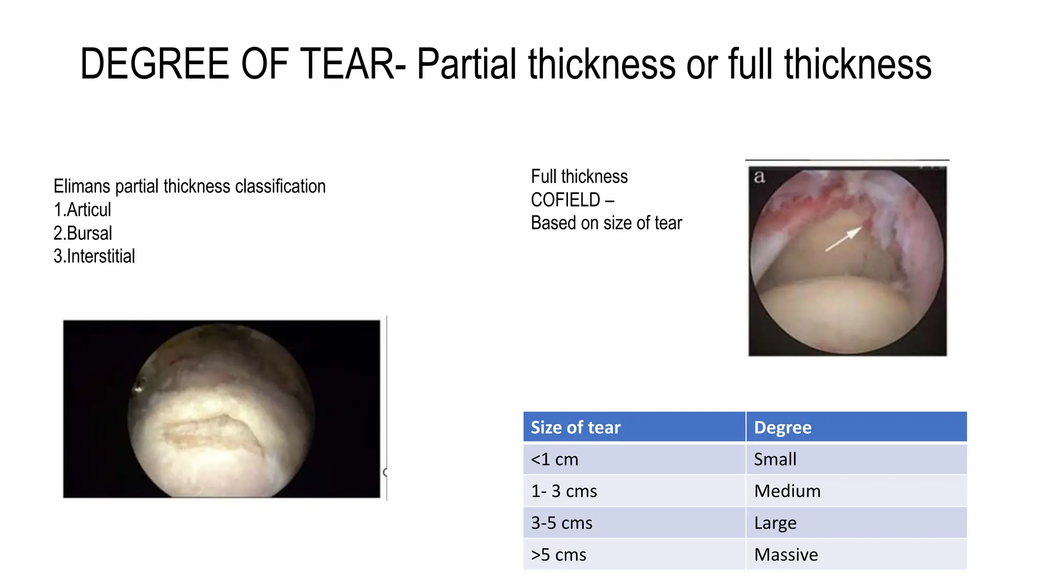 Rotator Cuff Injuries present at Chirayu Medical College.pptx