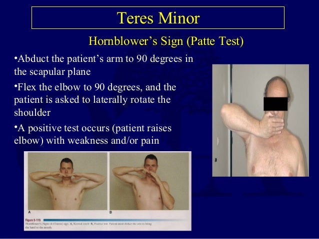 Rotator Cuff Injuries - Dr.CHINTAN N. PATEL