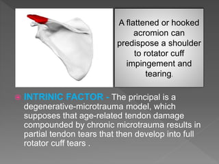 ROTATOR CUFF INJURY.pptx