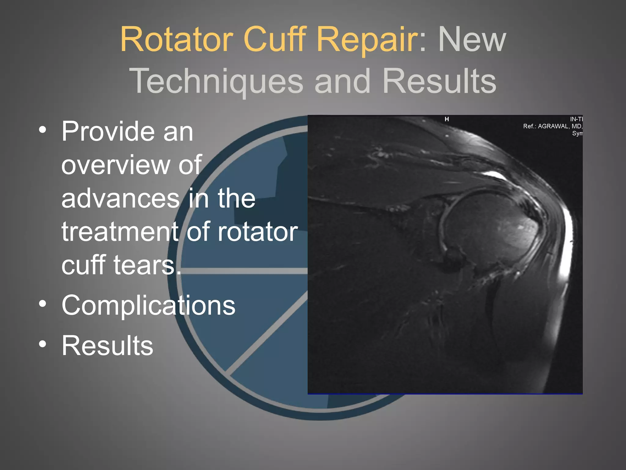 Rotator cuff Repair - New Techniques and Challenges | PPT