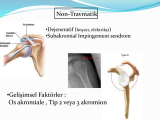 Rotator cuff yırtıkları | PPTX