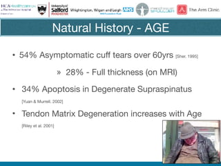 Rotator cuff tear management 2019 | PDF