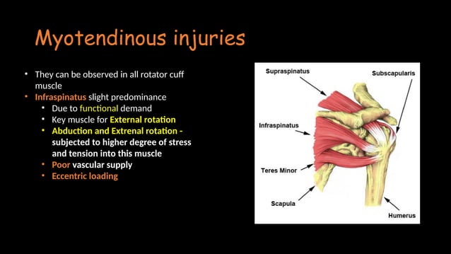 ROTATOR CUFF TEAR PATTERNS and normal.pptx