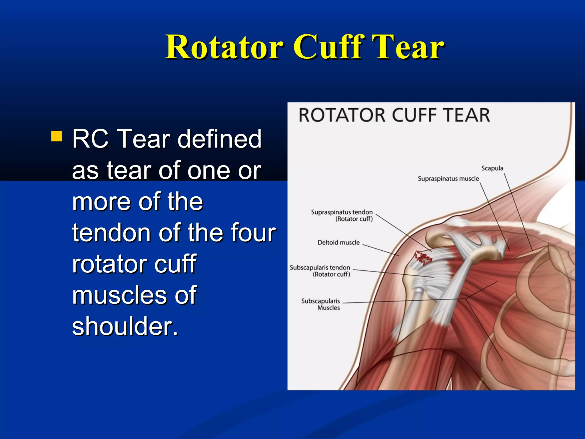 Rotatory cuff syndrome & Scapular Dyskinesia | PPT