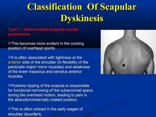 Rotatory cuff syndrome & Scapular Dyskinesia | PPT