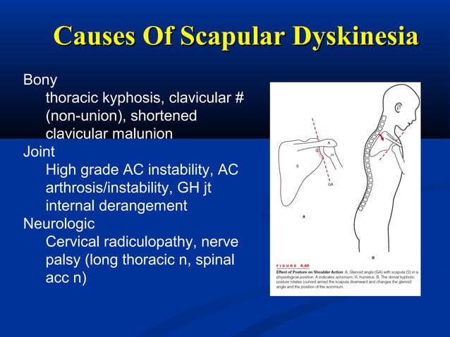 Rotatory cuff syndrome & Scapular Dyskinesia | PPT