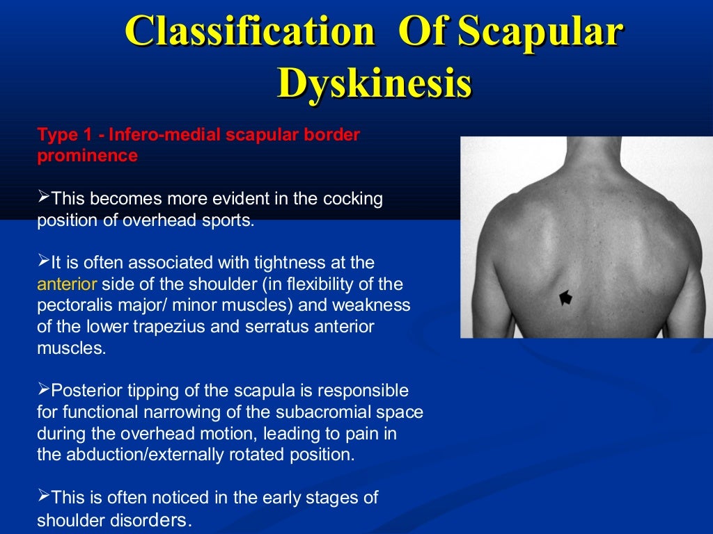 Rotatory cuff syndrome & Scapular Dyskinesia