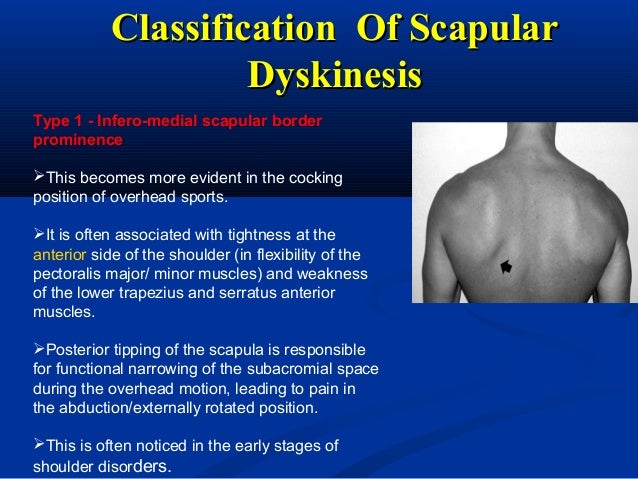 Rotatory cuff syndrome & Scapular Dyskinesia