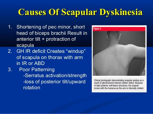 Rotatory cuff syndrome & Scapular Dyskinesia