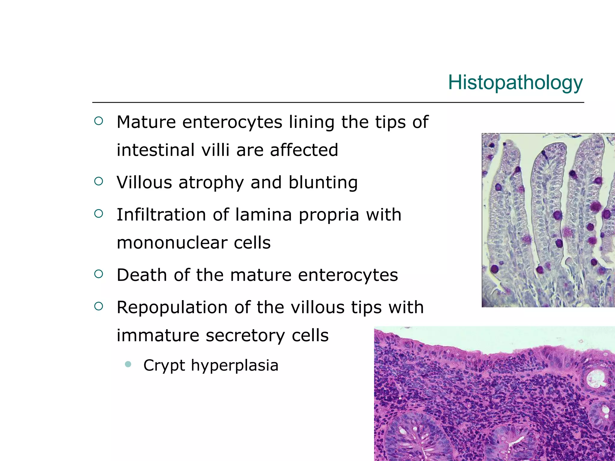 Rotavirus | PPT
