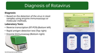 Rotavirus – The Invisible Killer of Infants | PPTX