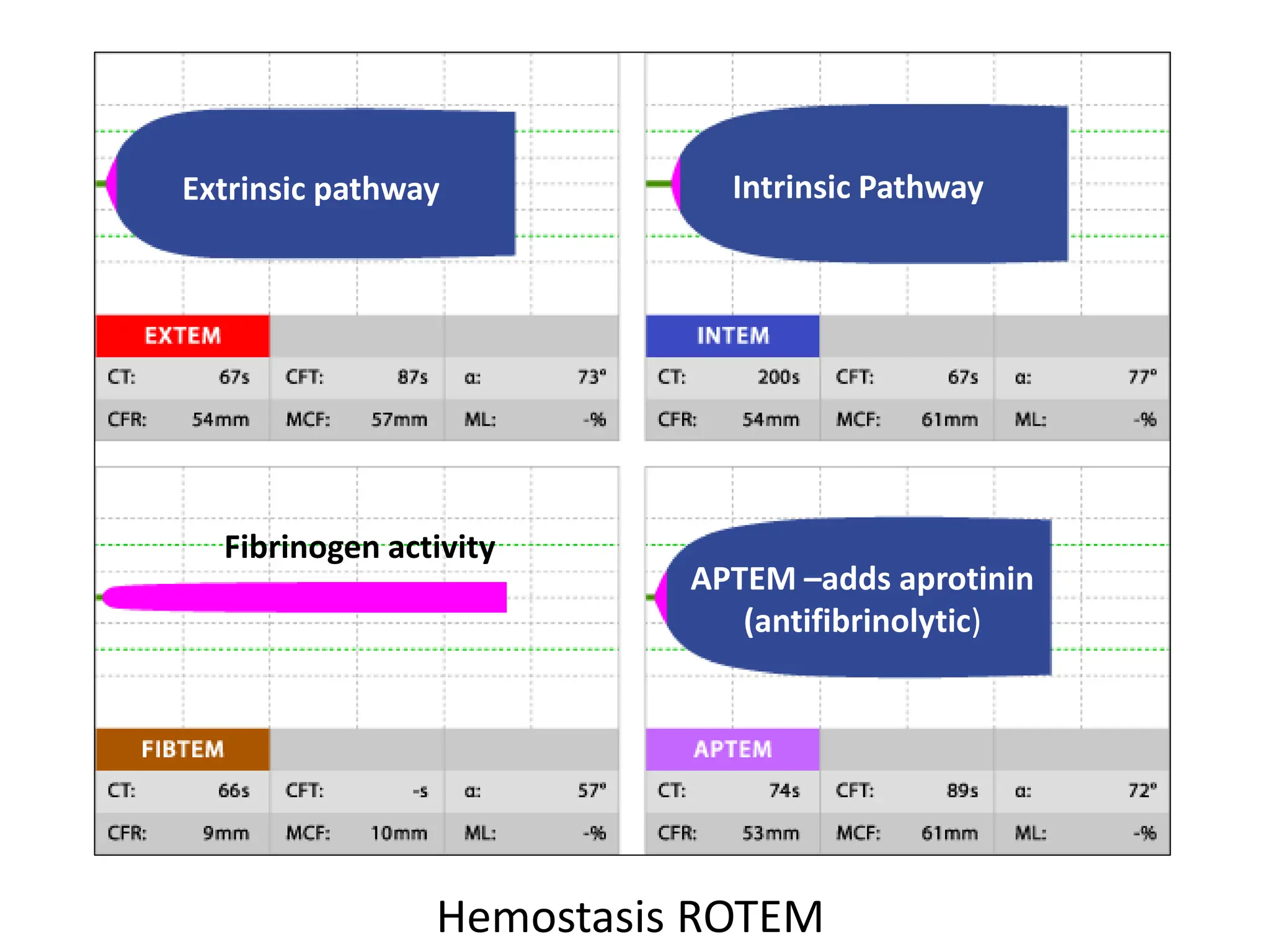 ROTEM - An Introduction and overview.pptx