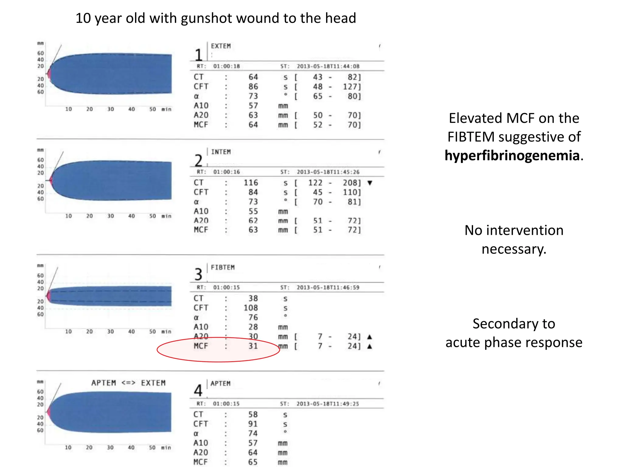 ROTEM - An Introduction and overview.pptx
