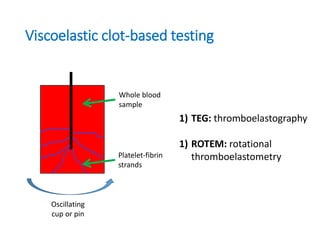 ROTEM - An Introduction and overview.pptx