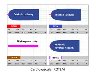 ROTEM - An Introduction and overview.pptx